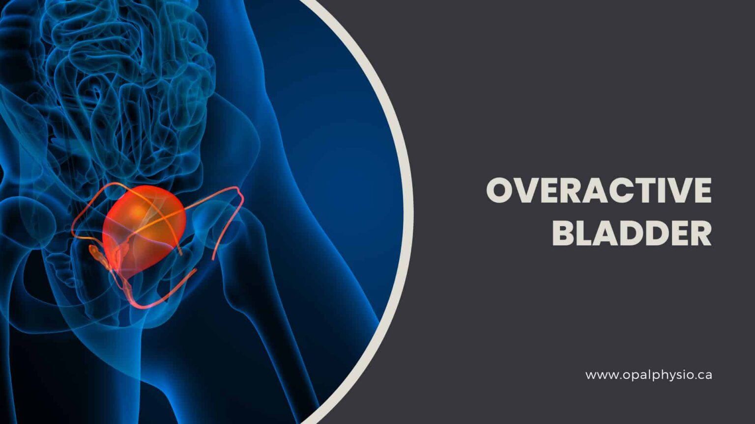Overactive Bladder Treatment | Langley, BC