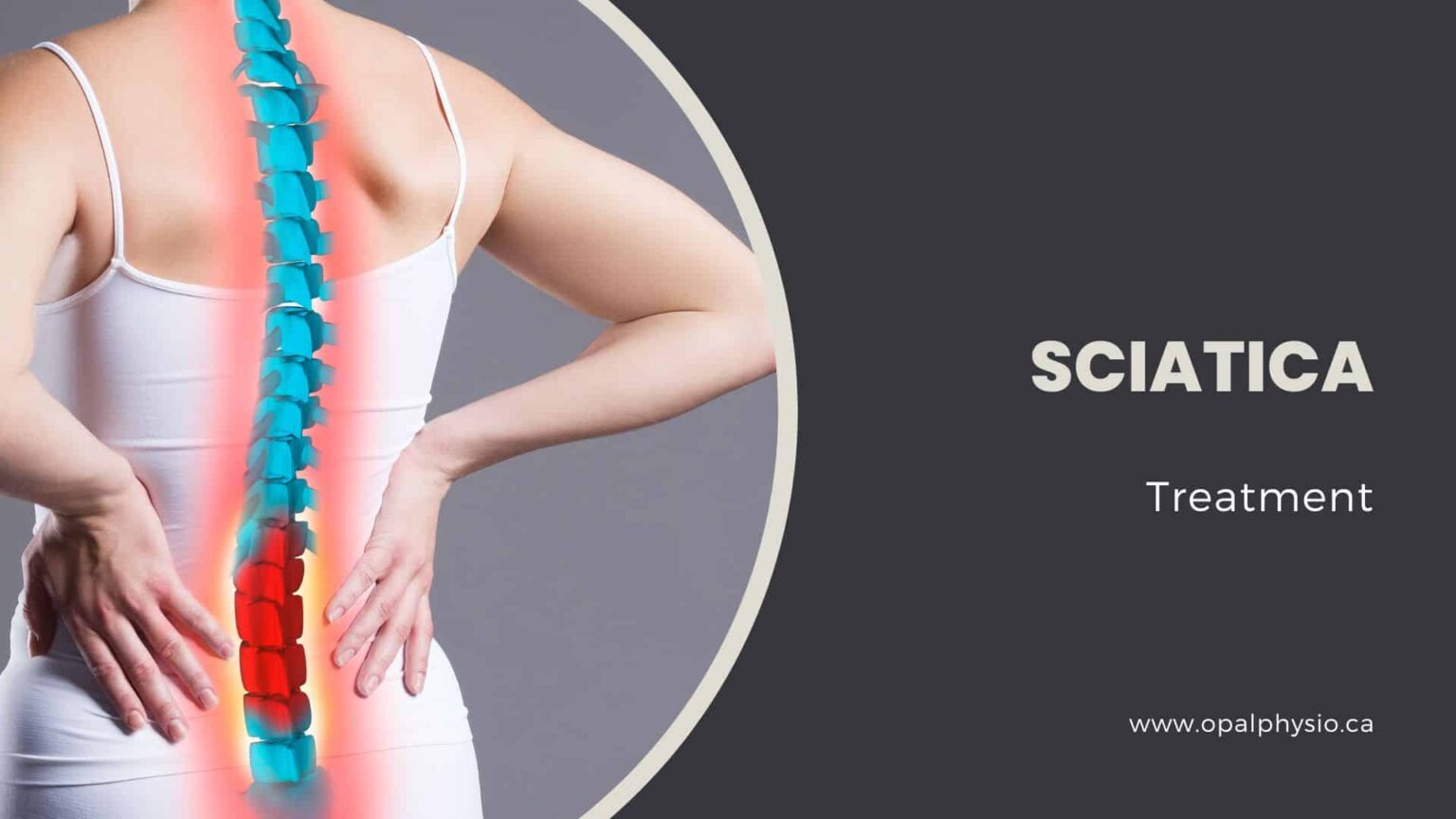 Professional Sciatica Treatment | Langley, BC