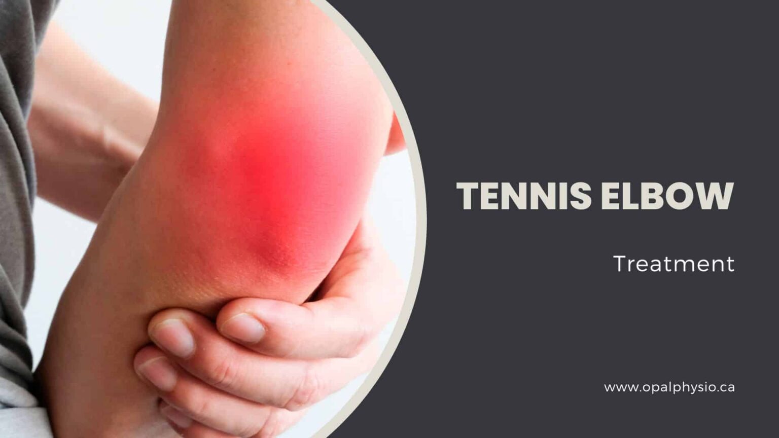 Tennis Elbow Physiotherapy Treatment