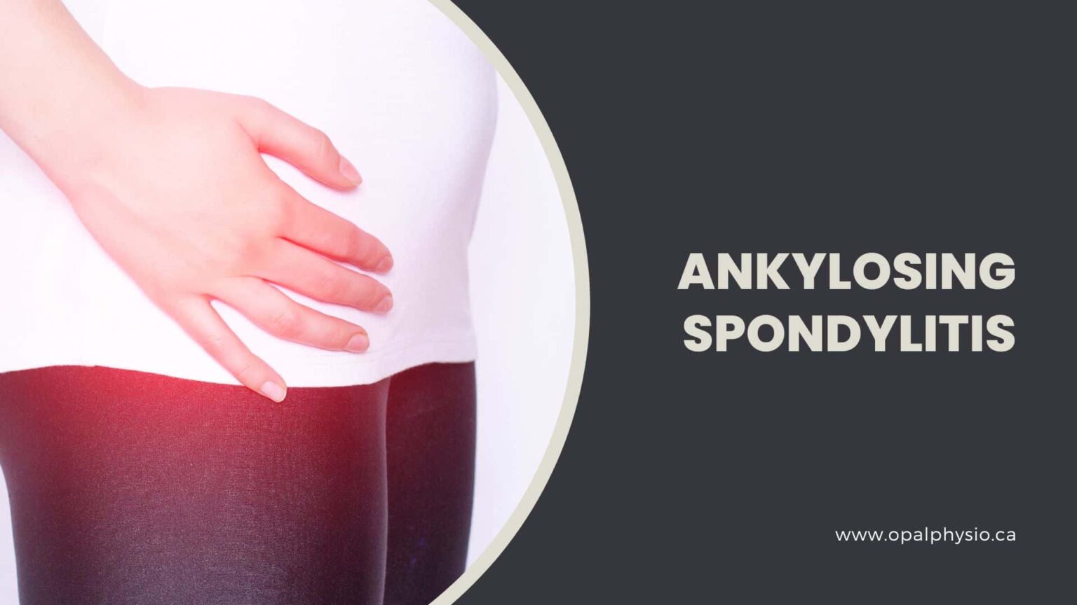 Ankylosing Spondylitis