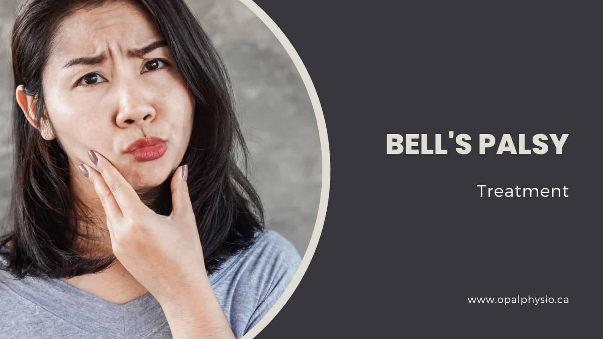 Bell's Palsy
