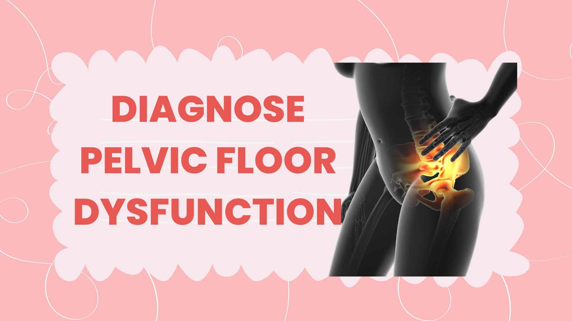 Guide To Pelvic Floor Dysfunction