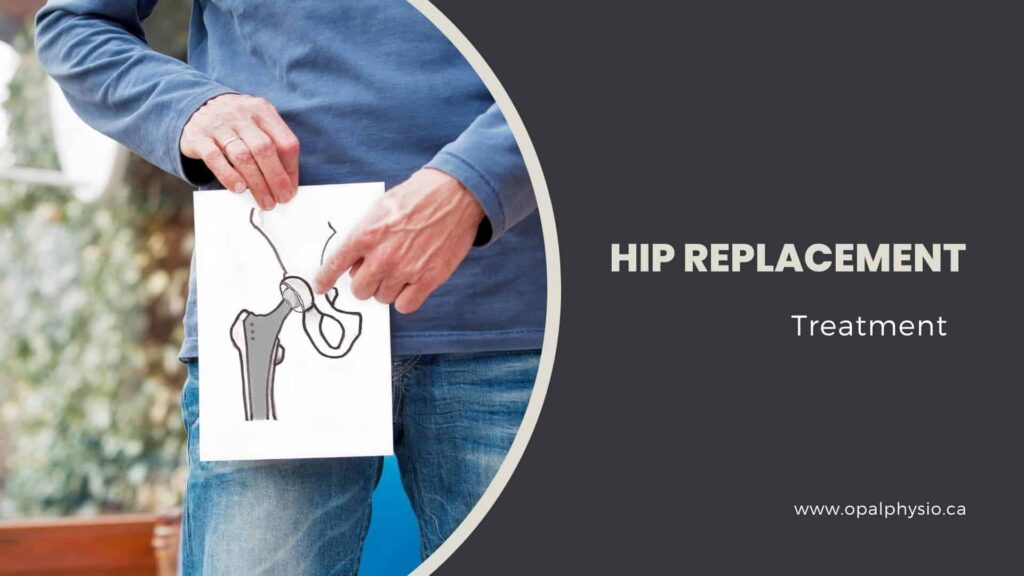 Hip Replacement