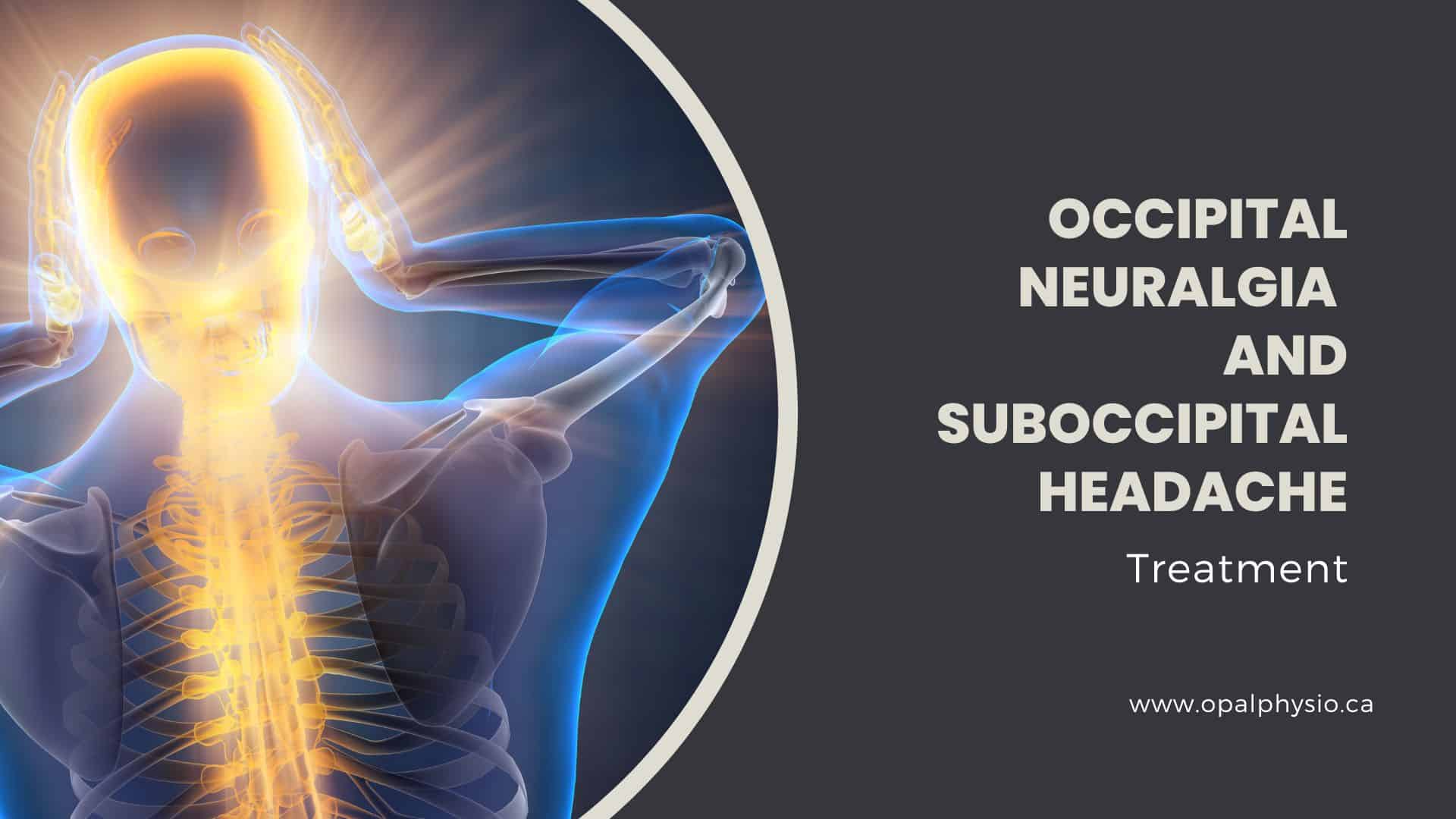 Occipital Neuralgia | Suboccipital Headache | Physiotherapy Treatment