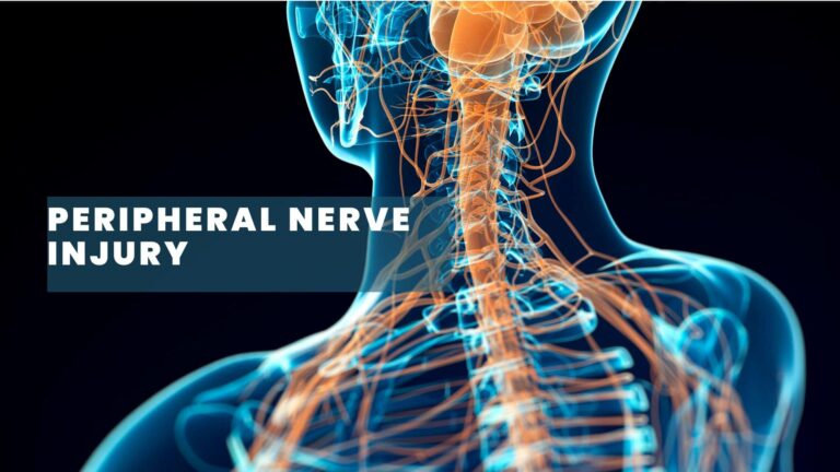 Peripheral Nerve Injury Treatment | Langley, BC